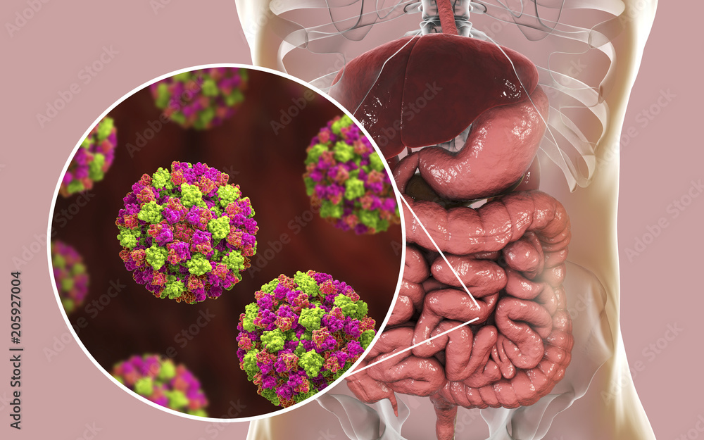Norovirus in human intestine, also called winter vomiting bug, RNA ...