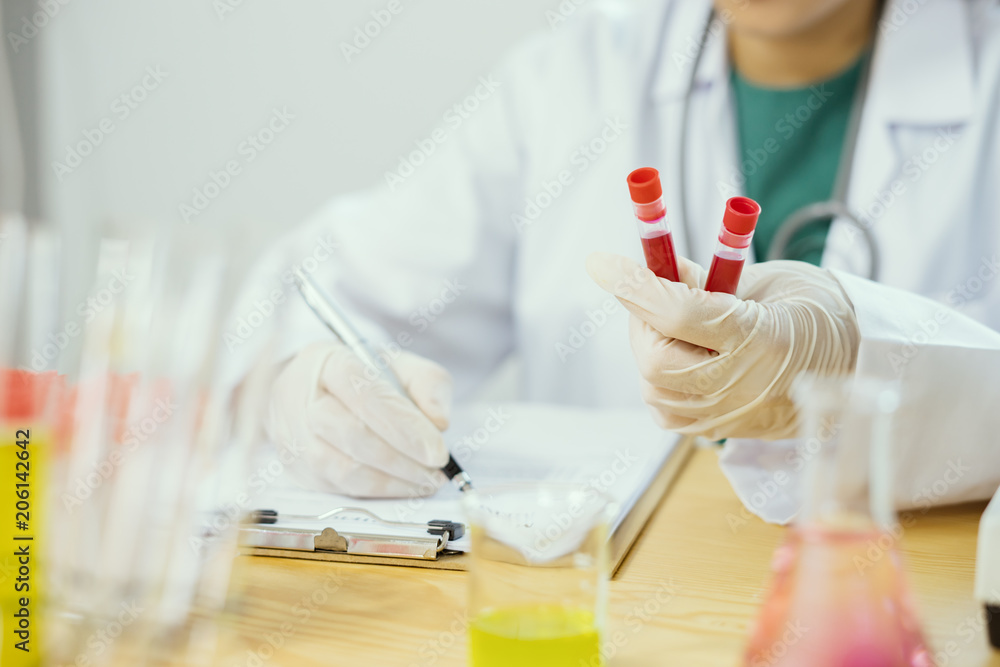 hands a medical doctor holding blood sample and making notes writing on ...