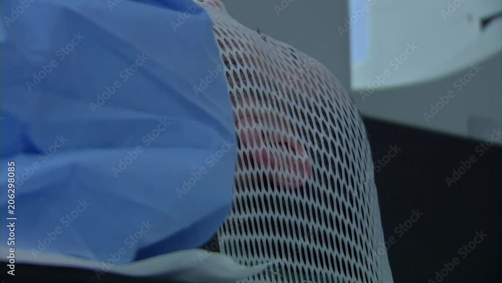 Vidéo Stock Close up side view of a patient's head wearing mesh mask ...