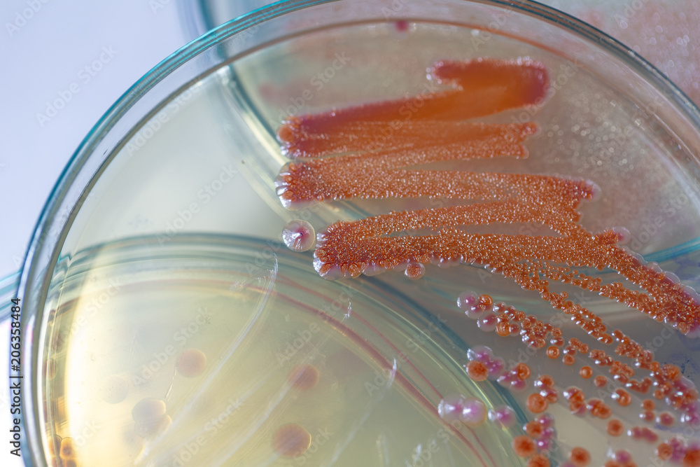 Serratia Marcescens Gram Stain