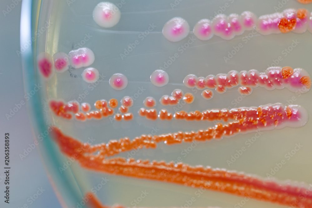 Serratia marcescens is a species of rod-shaped gram-negative bacteria ...