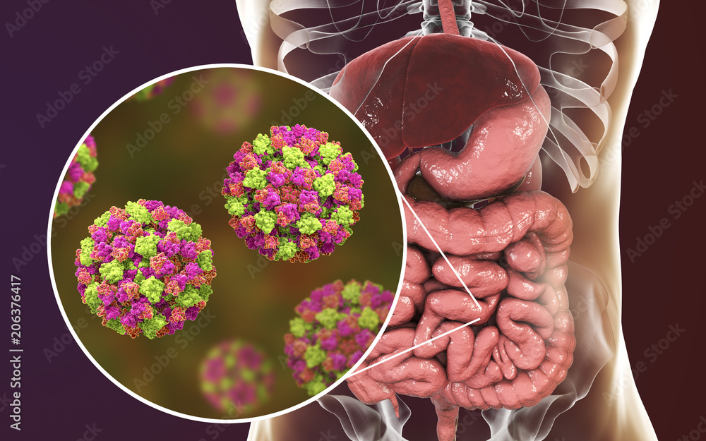 Norovirus in human intestine, also called winter vomiting bug, RNA ...