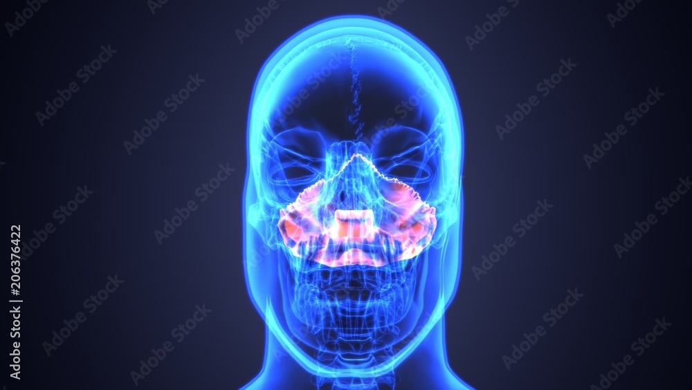 3d illustration of Sinusitis . of human skull with inflamed at sinus ...