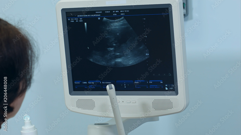 Female gynecologist checking fetal life with ultrasound scanner Stock ...