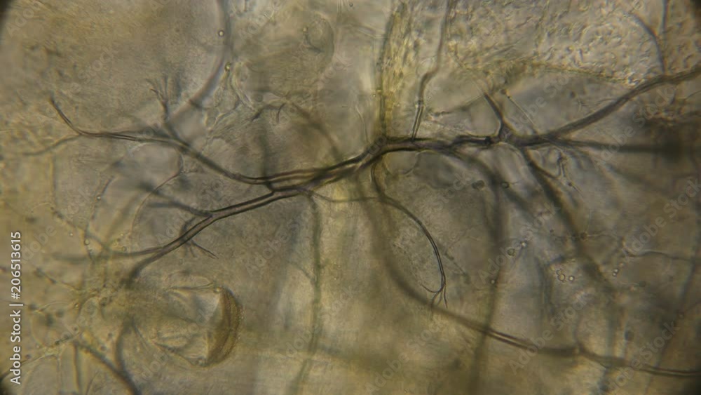 structure of internal organs of the larva Lesser water boatman under a ...