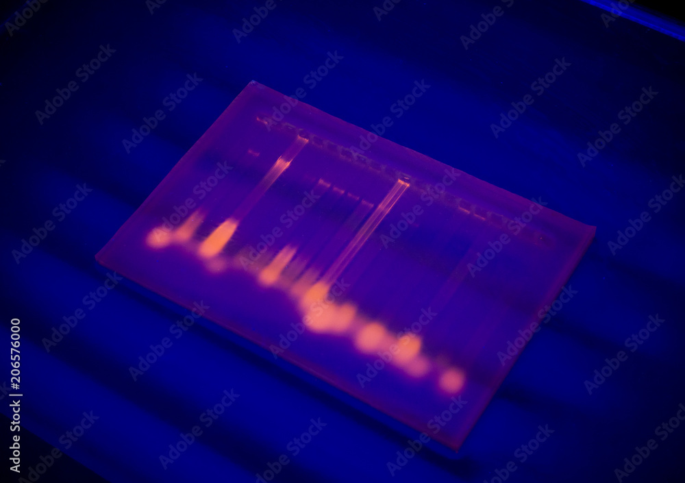 Electrophoresis Results