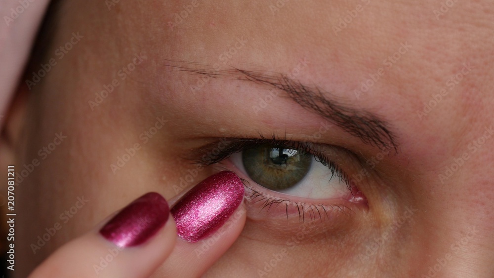 The girl puts the medicine on the eye. Eye treatment. Conjunctivitis ...