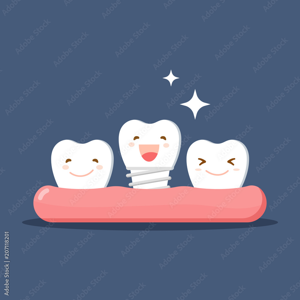 Vector cartoon white teeth happy with denture or Dental implant ...