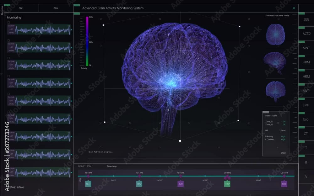 User Interface Mock-up: Futuristic Medical Concept of the Brain Scan ...