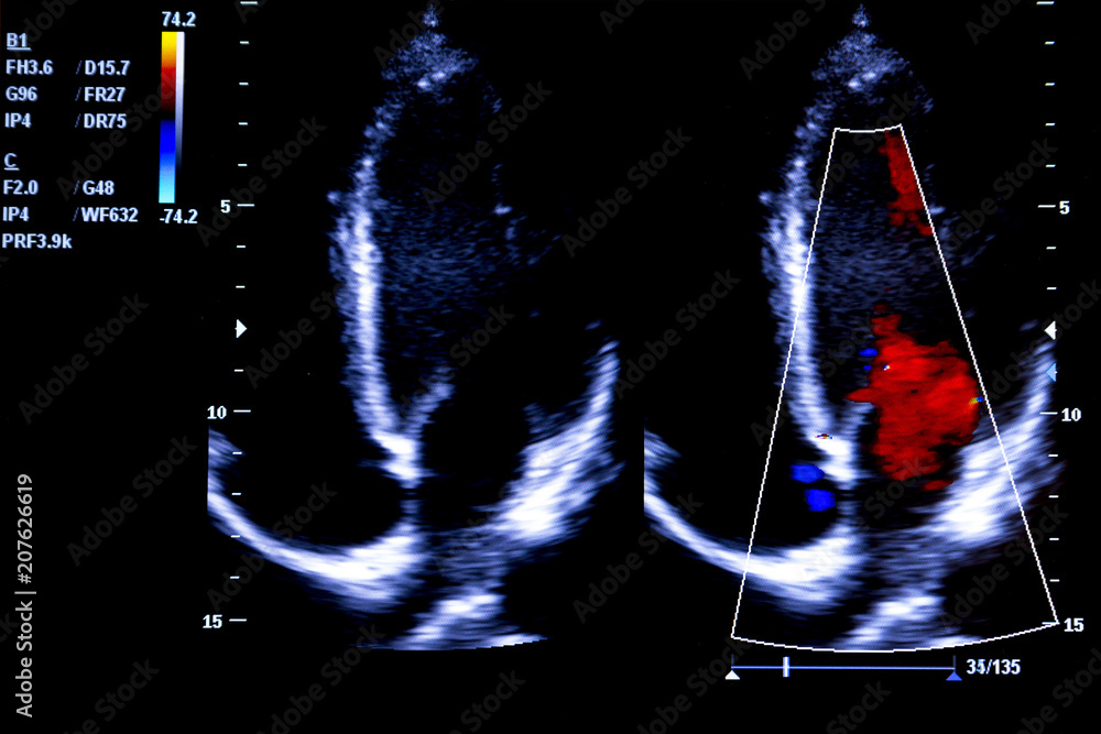 Colourful image of homan heart ultrasound monitor Stock Photo | Adobe Stock