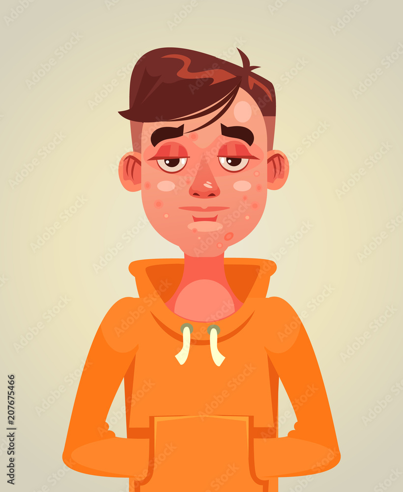Sad unhappy teen boy man with acne on face. Skin problem flat cartoon ...