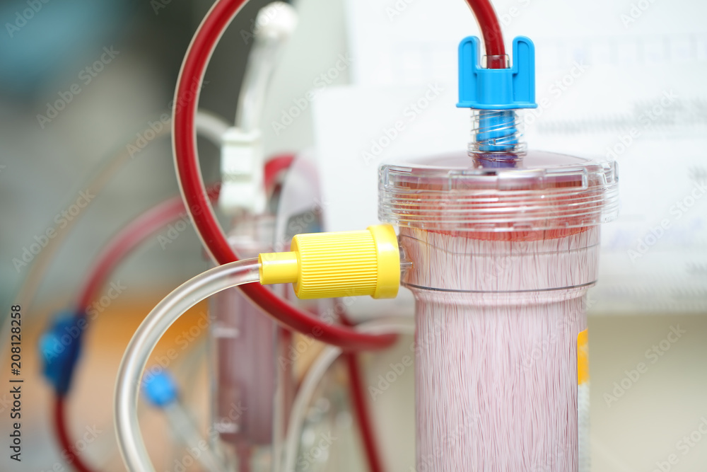 Part of a dialysis equipment during process of blood filtration Stock ...