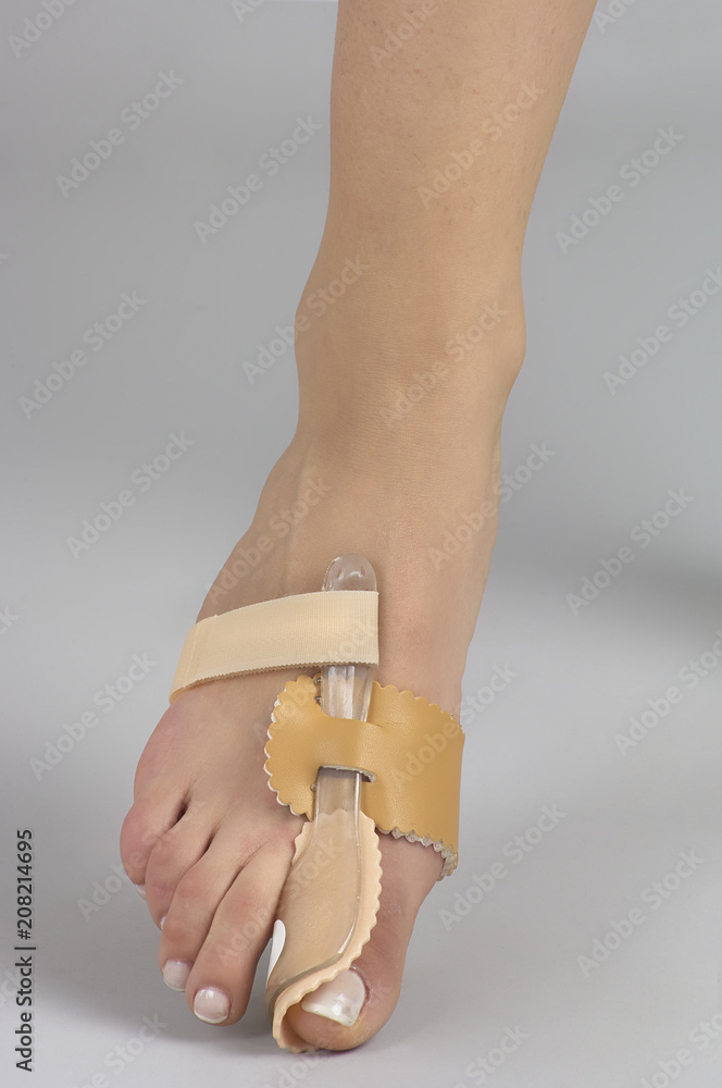 Toe splint,hallux valgus splint Stock Photo | Adobe Stock