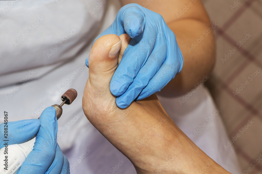 Professional hardware pedicure using electric machine.Patient on ...