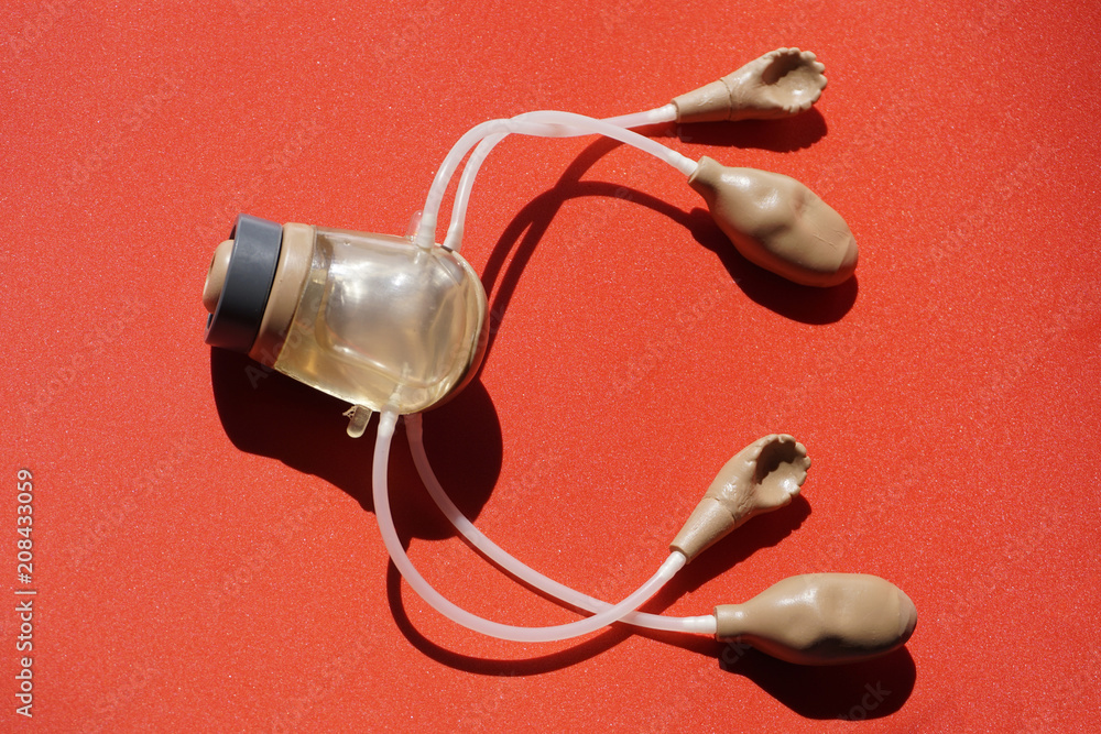 Simulation medicine model of the uterus, ovaries and Fallopian tubes ...