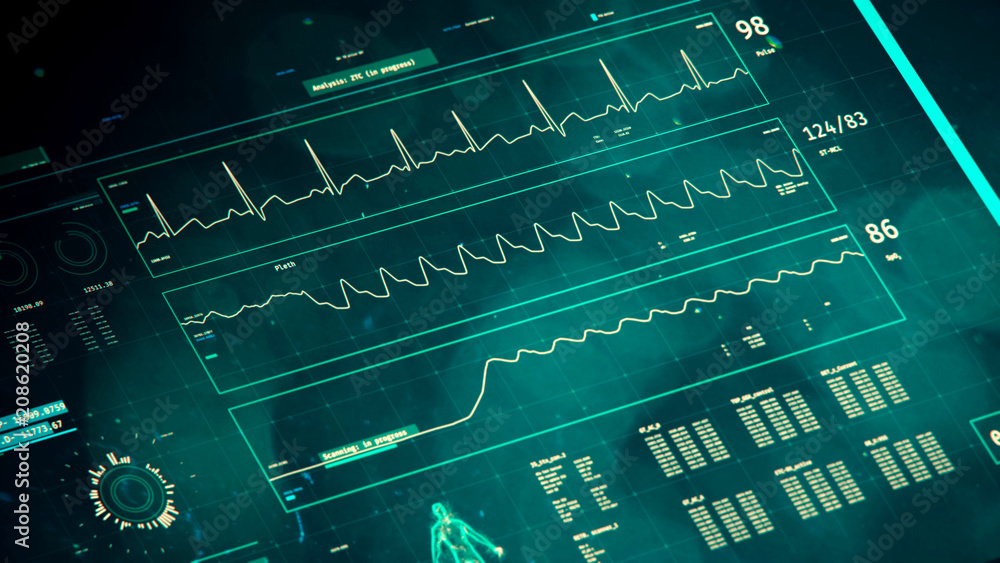 Poster Patient's clinical death, reviving on ICU monitor, heart beating ...