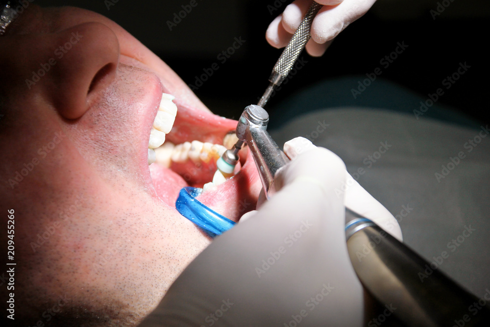 Dental check up. Dental male patient at regular dental check, at dental ...