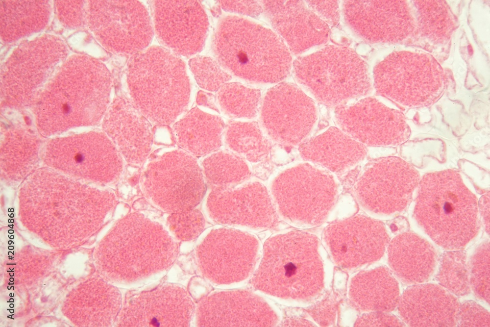 Root bacteria nodules under the microscope. Stock Photo | Adobe Stock