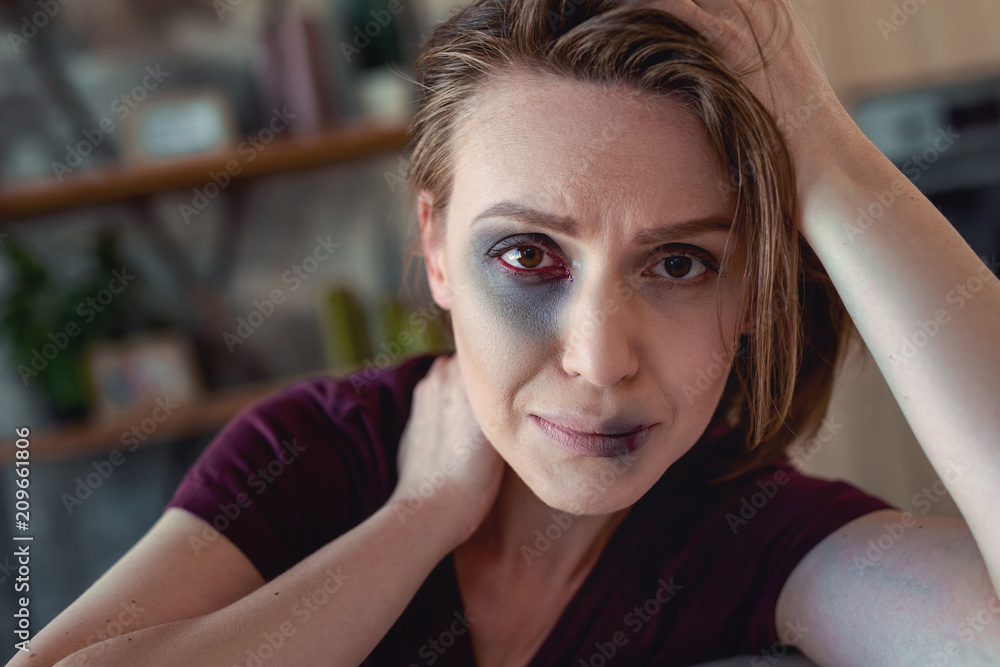 Damaged face. Dark-haired young woman crying with all eyes in tears ...