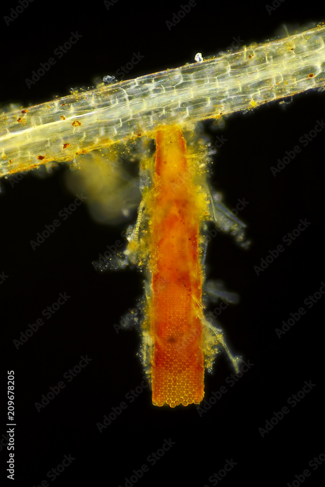 Microscopic view of unspecified eggs in tube shaped packet on Common ...