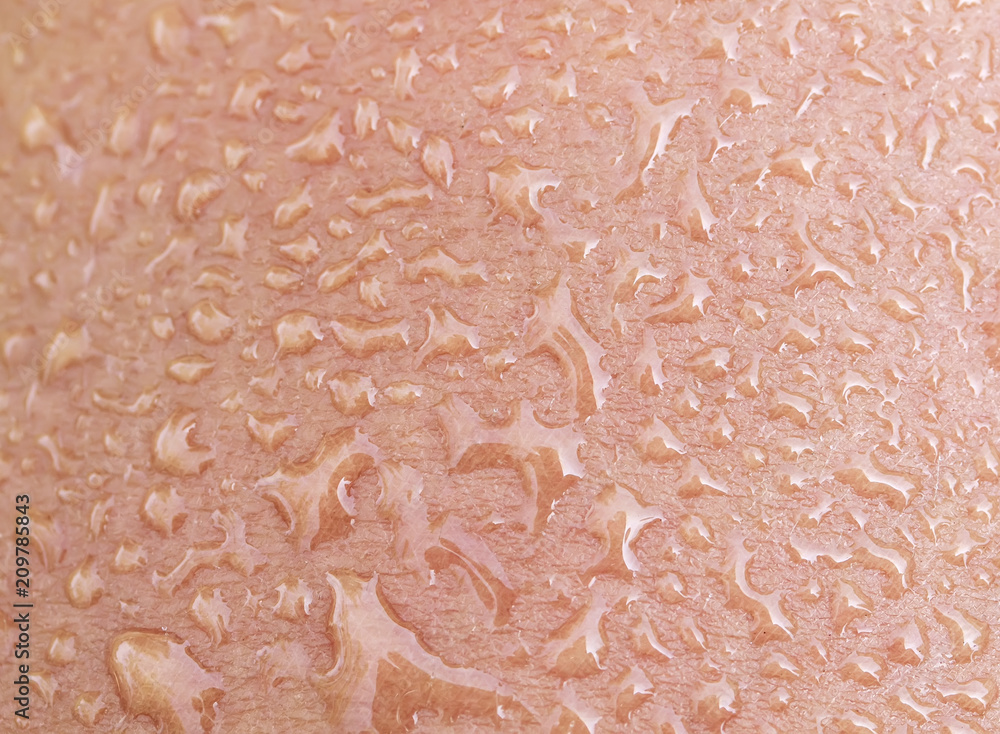 background of human skin texture covered with large drops of fresh ...