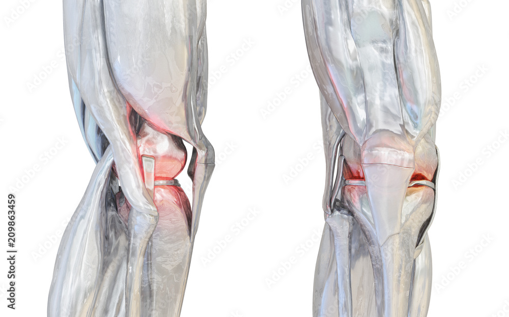 Human Knee Bones