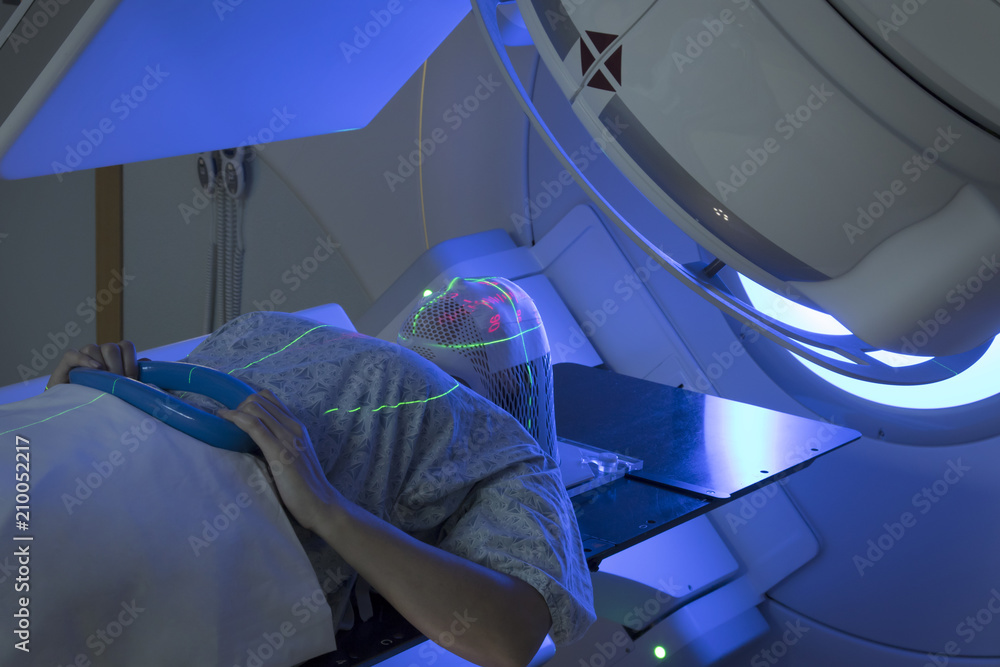 Woman Receiving Radiation Therapy Treatments for Brain Tumor (Cancer ...