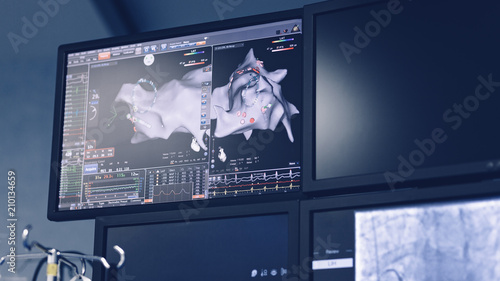 Heart electroanatomic map using new technologies focusing on new ...