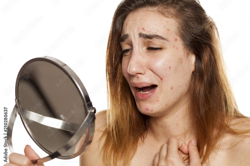 young unhappy woman with problematic skin and without makeup looking ...