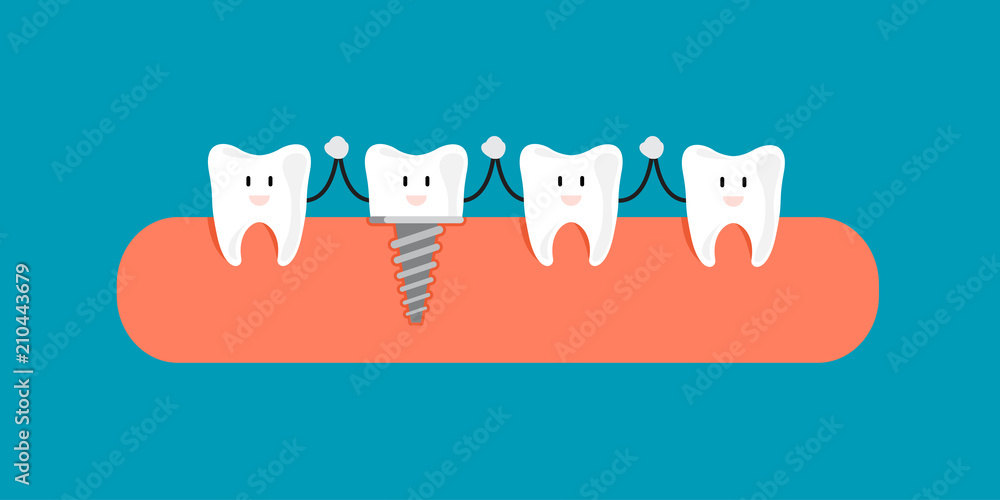 Fun concept with Filling dental implant with crown. 4 happy tooth in ...