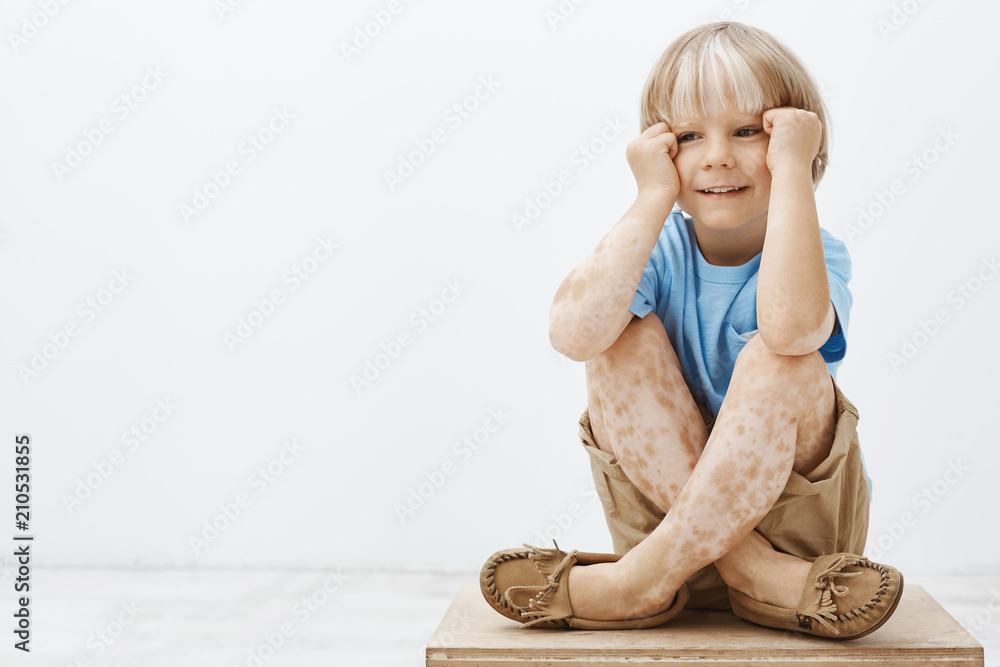 Cute little boy with blond hair and spots on skin, sitting with crossed ...
