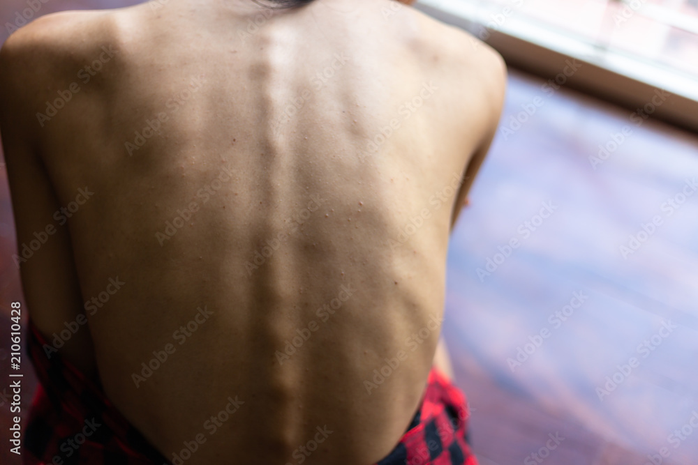 Portrait anorexia model woman. Beautiful model woman looks skin and ...