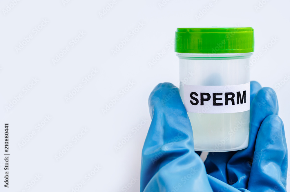 Health. Sample sperm. Donor Sperm Close up Concept Bank Sperm Doctor in ...