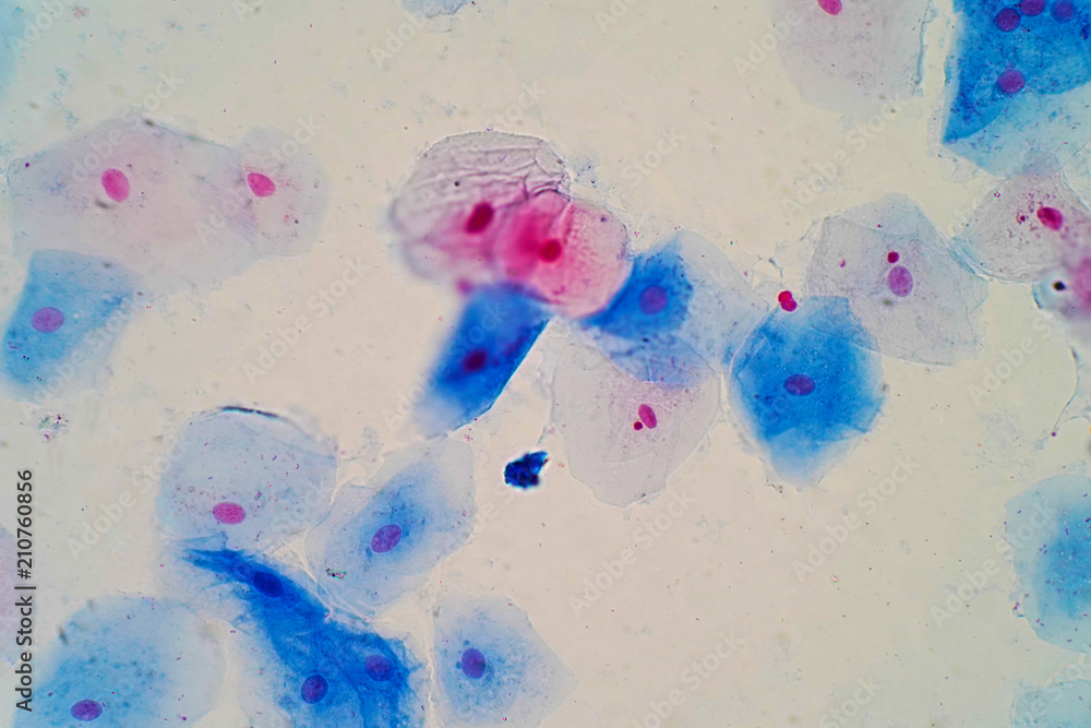 Squamous epithelial cells under microscope view for education histology ...