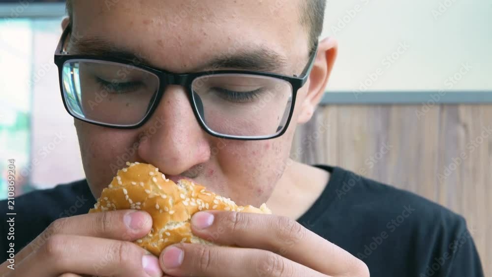 A young man with acne on his face eats hamburger in a fast food ...