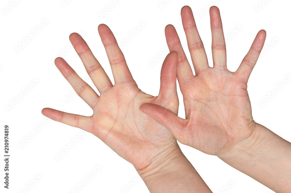 White Person Hand