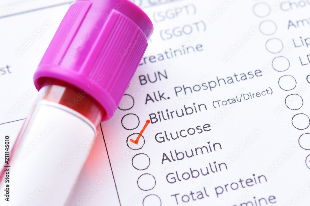 Blood sample tube with laboratory requisition form for glucose test ...