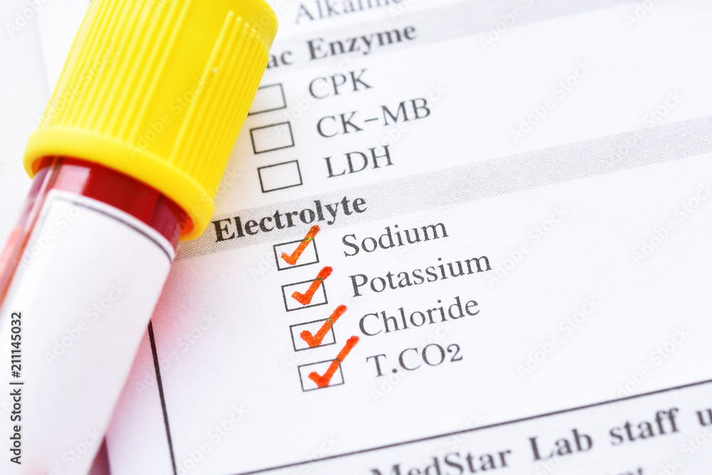 Blood sample tube with laboratory requisition form for electrolyte test ...