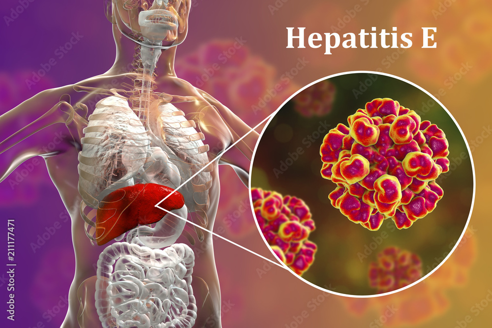Hepatitis E viral infection, 3D illustration. Non-enveloped RNA viruses ...