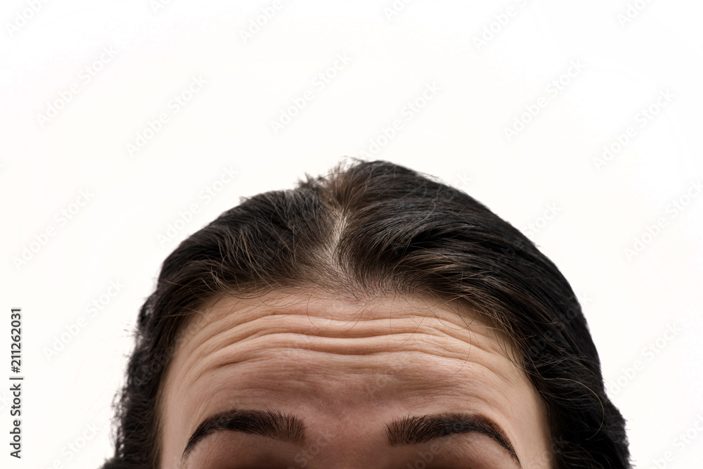 First wrinkles. Girl with wrinkles on forehead. Portrait of young woman ...