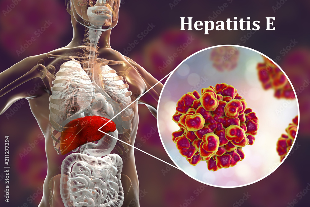 Hepatitis E viral infection, 3D illustration. Non-enveloped RNA viruses ...