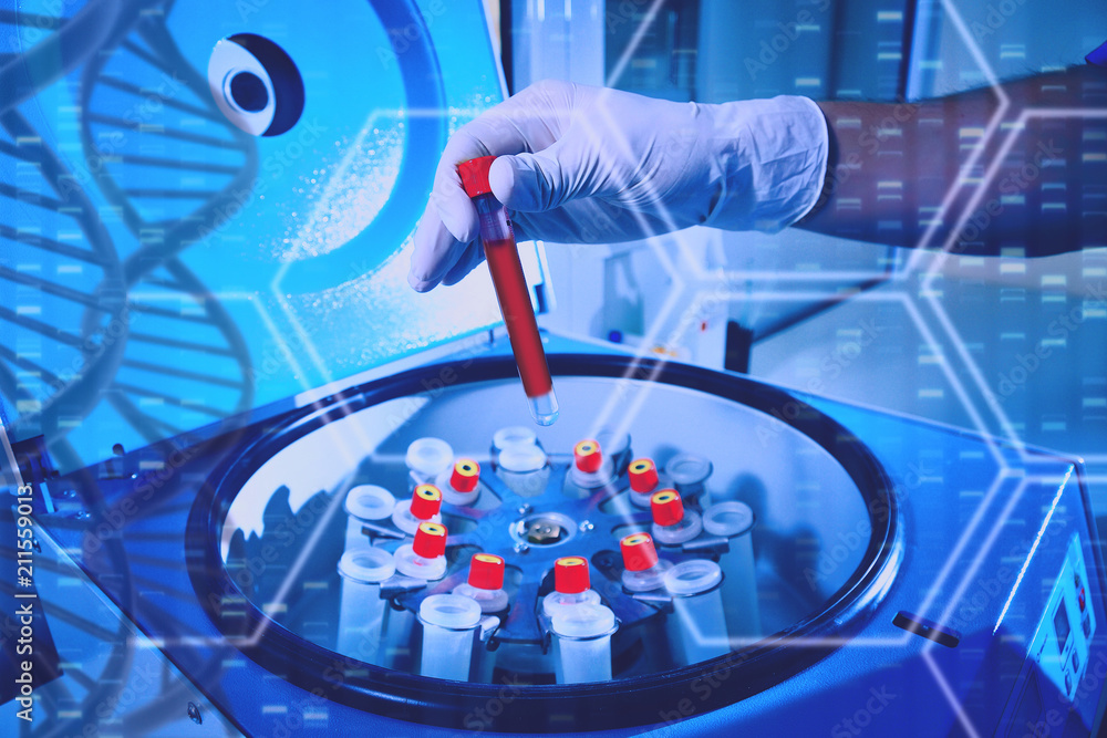 Analysis of dnk. A hand in a medical glove holds a test tube with DNA ...