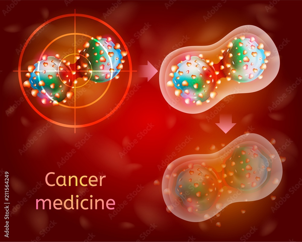Cancer Medical Treatment Realistic Vector Concept Stock Vector | Adobe ...