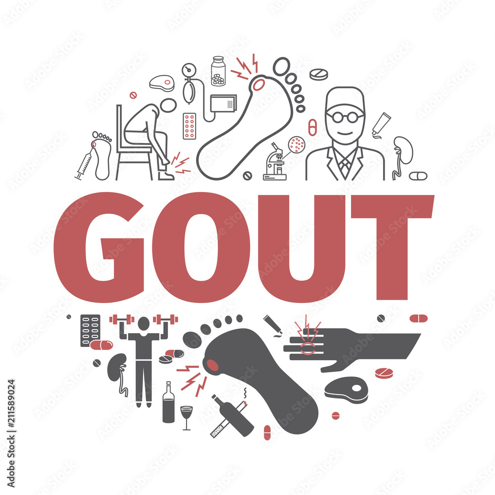 Gout banner. Symptoms, Treatment. Vector signs for web graphics. Stock ...