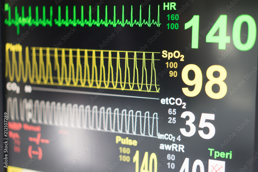 Hospital Heart Monitor
