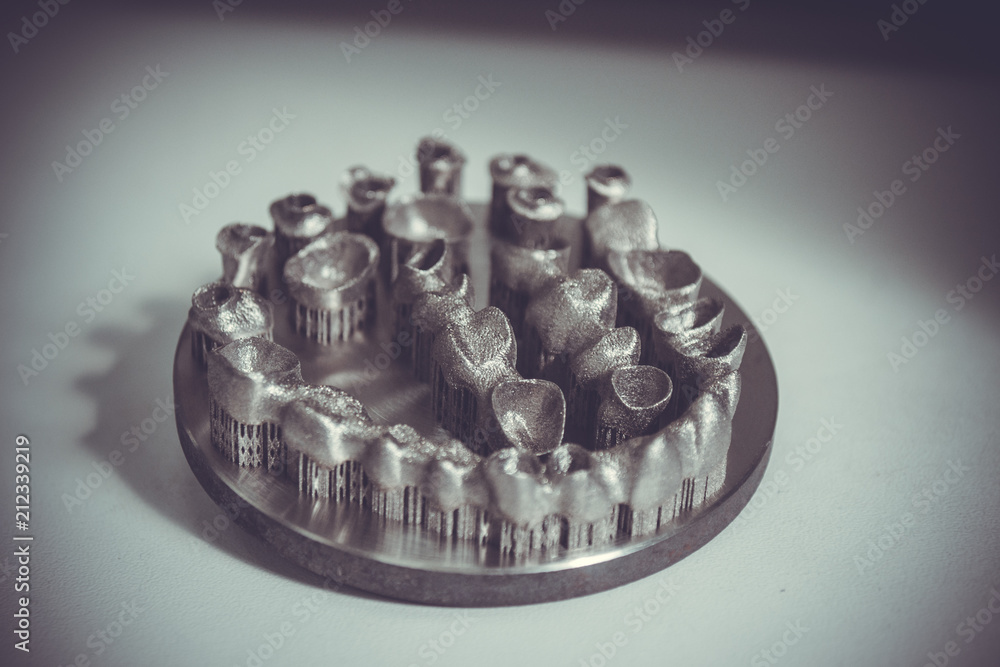 Object printed on metal 3d printer. Dental crowns created in a laser ...