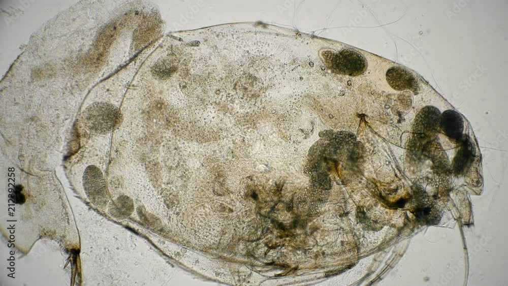 in the dead body of crustaceans Daphnia wound up colony Tetrachimens ...