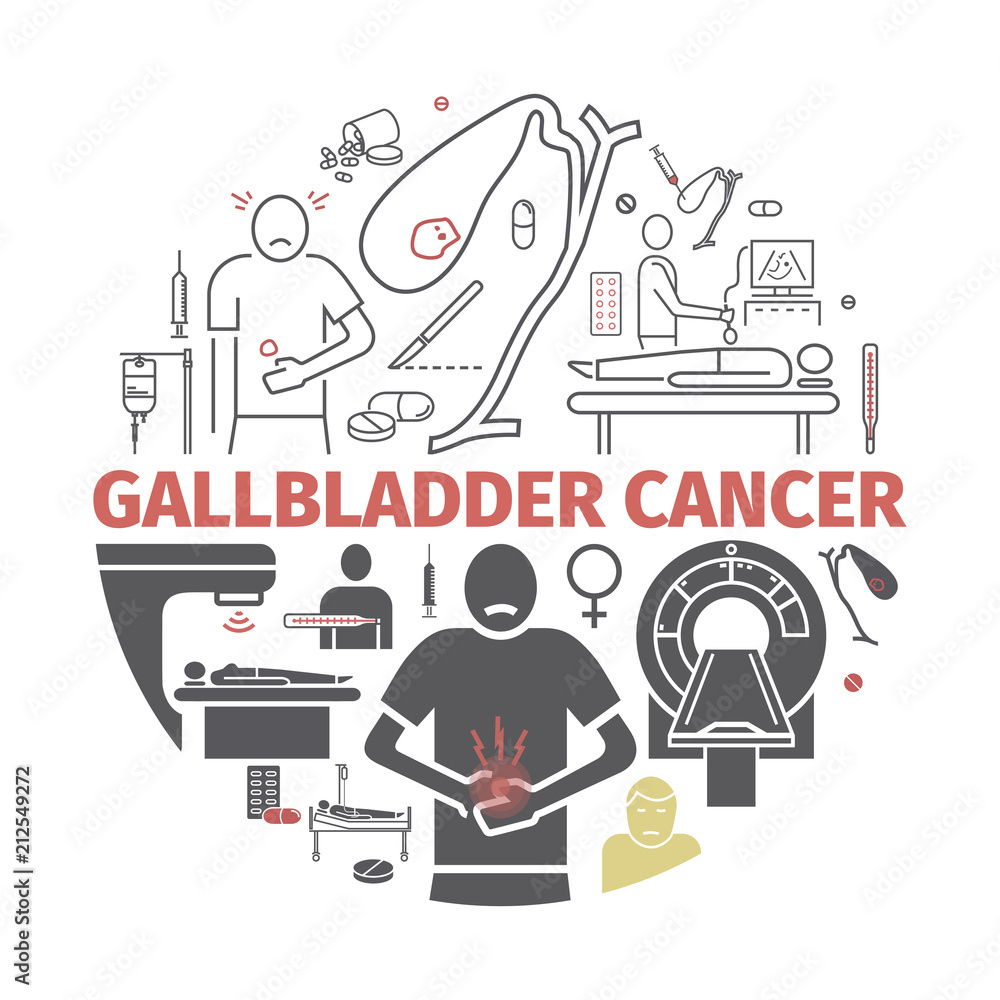 Gallbladder Cancer banner. Symptoms, Treatment. Vector signs for web ...