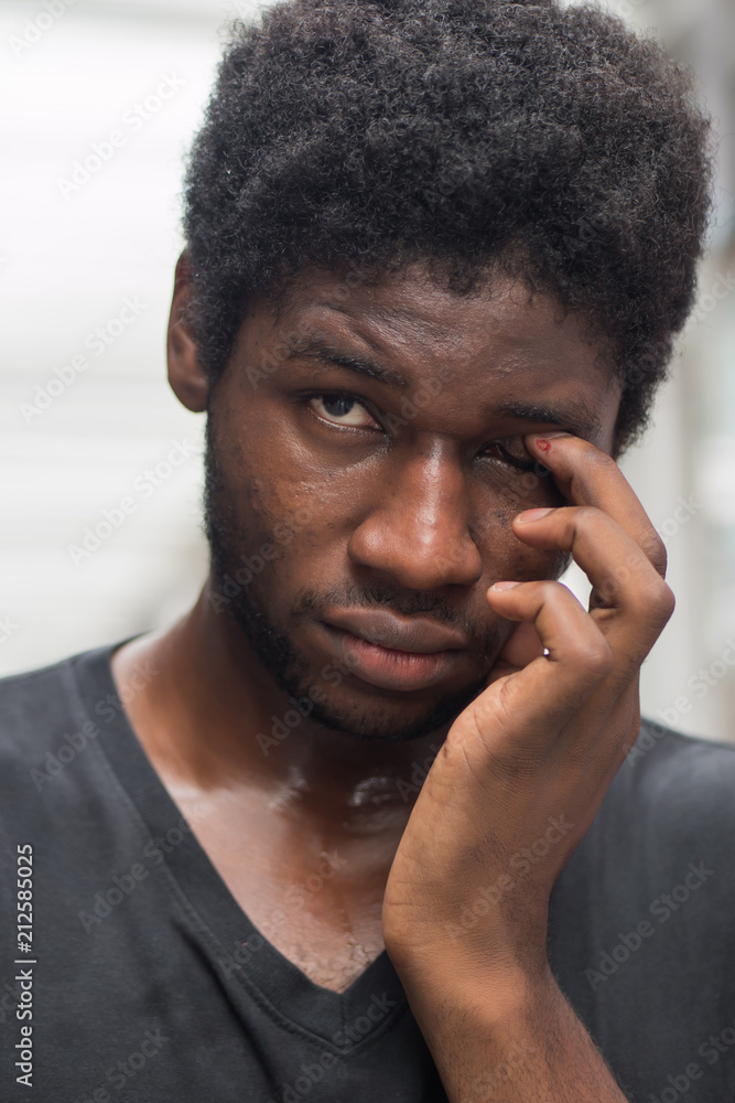 man suffering from irritated eye; sick african man with eye pain, sore ...