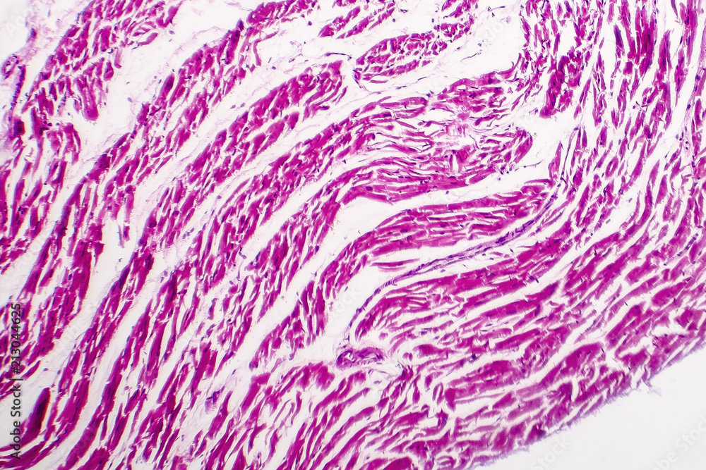 Brown atrophy of the heart, light micrograph, photo under microscope ...